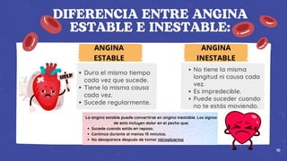 Angina Estable e inestable enfermeria y sus cuidadados | PDF