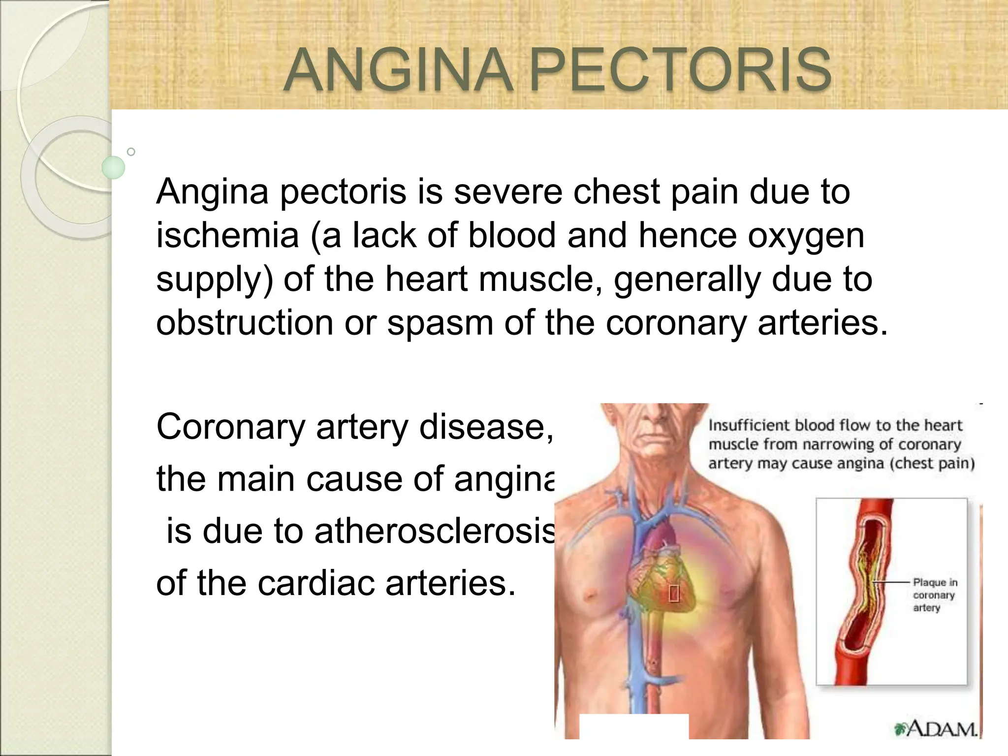ANGINA FROM ATTA.ppt