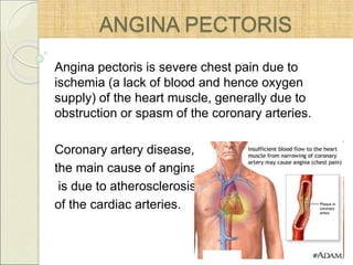 ANGINA FROM ATTA.ppt