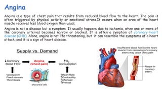 Angina Pectoris | PPTX