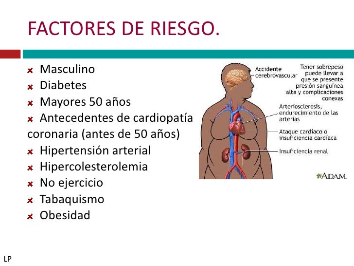 Angina inestable expo