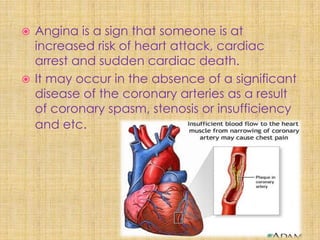 Angina pectoris | PPT
