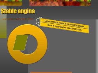 Angina pectoris | PPT