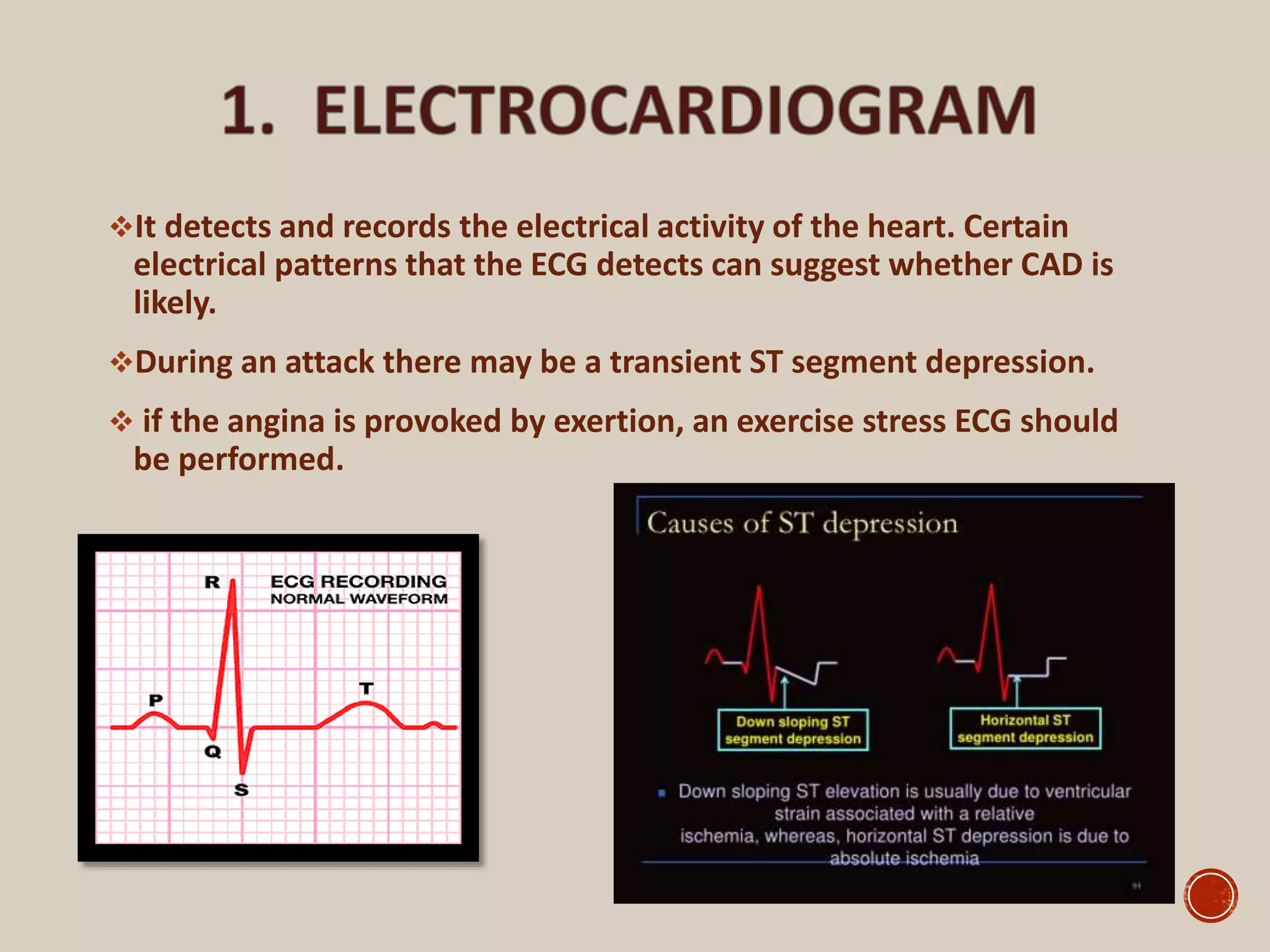 Angina pectoris | PPTX