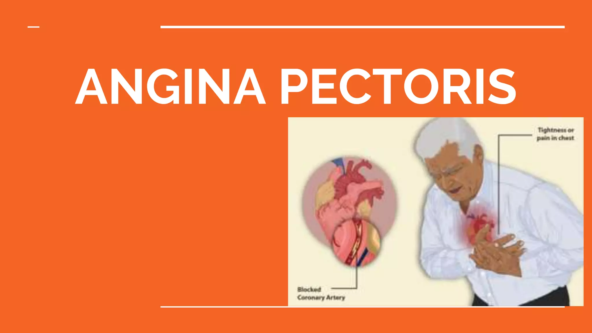 Angina pectoris (chest pain) | PPTX