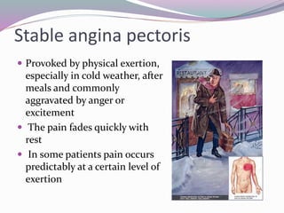 Angina pectoris | PPT