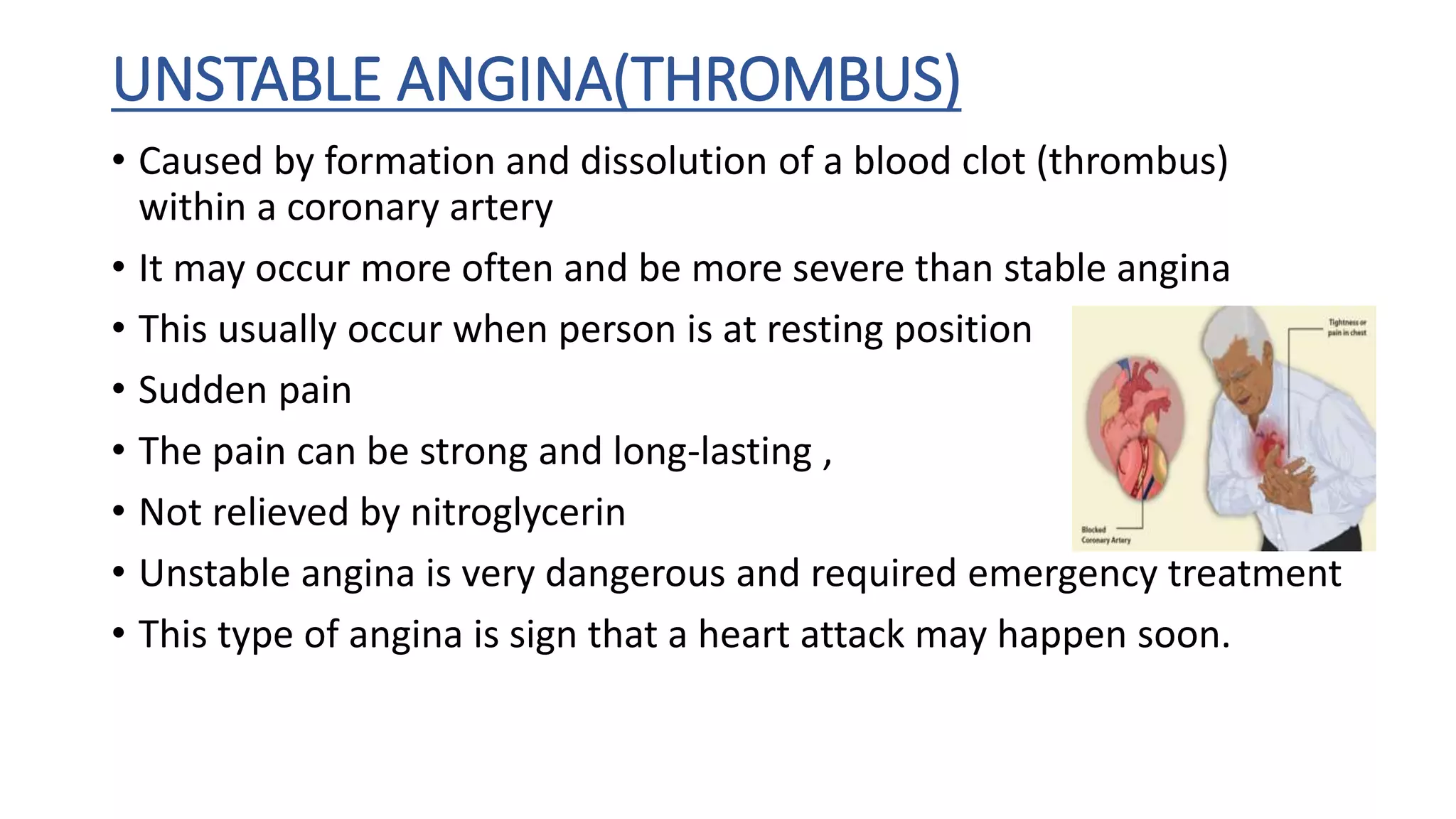 Angina pectoris | PPTX