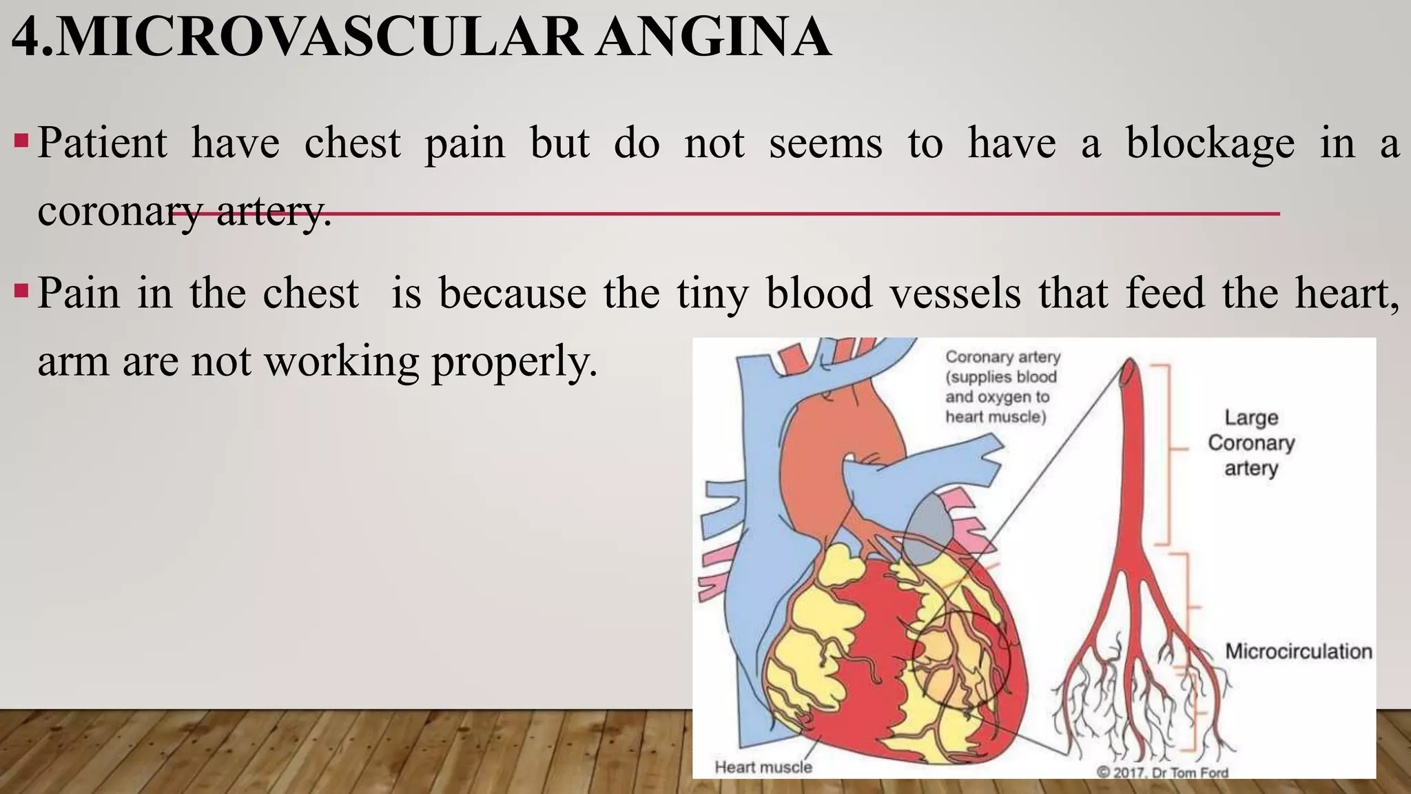 Angina pectoris.pdf