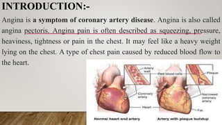 Angina pectoris.pdf