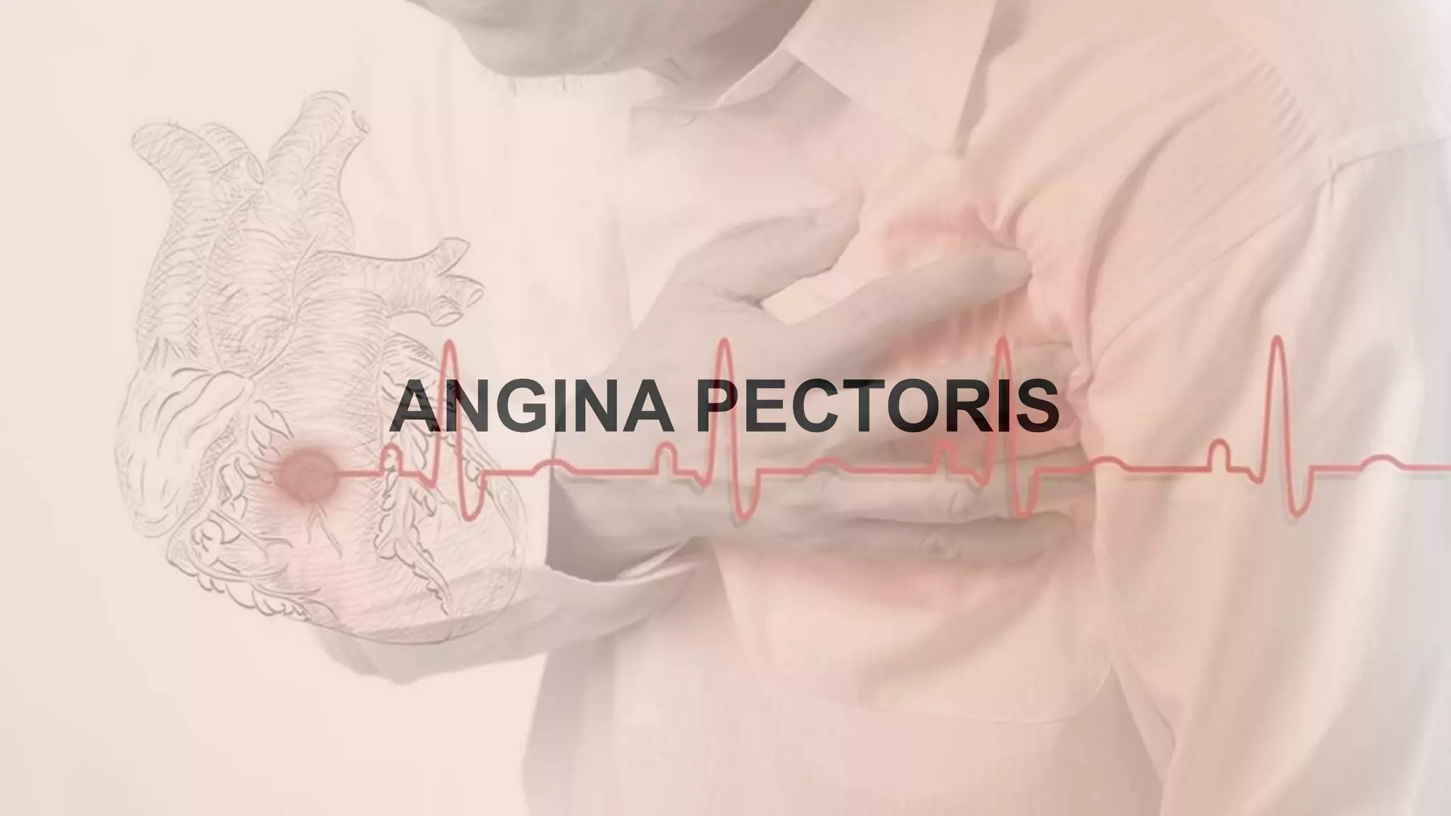 angina pectoris.pptx