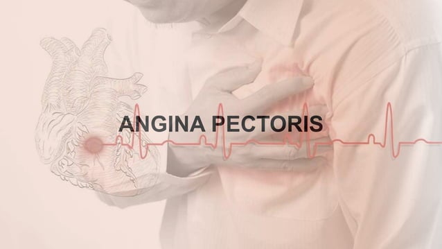 angina pectoris.pptx