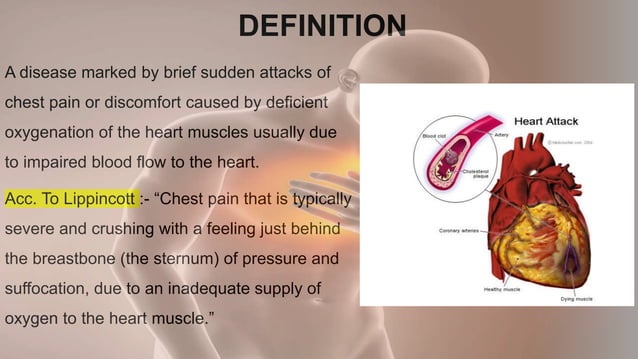 angina pectoris.pptx