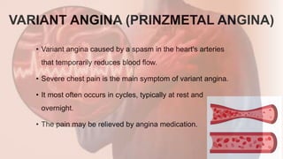 angina pectoris.pptx