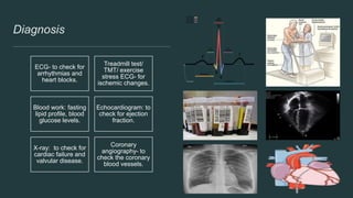 ANGINA PECTORIS | PPTX