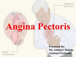 Angina Pectoris(Adult Health Nursing-I).pptx