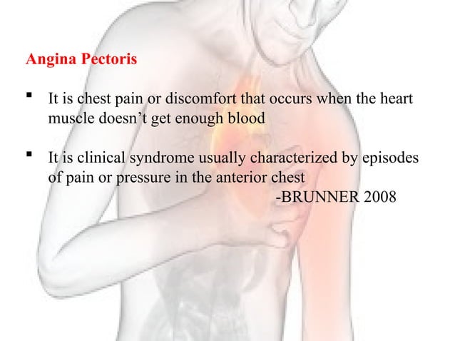 Angina Pectoris(Adult Health Nursing-I).pptx