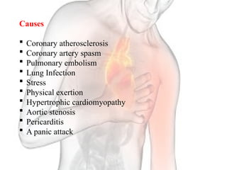Angina Pectoris(Adult Health Nursing-I).pptx