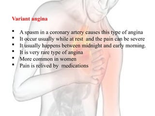 Angina Pectoris(Adult Health Nursing-I).pptx