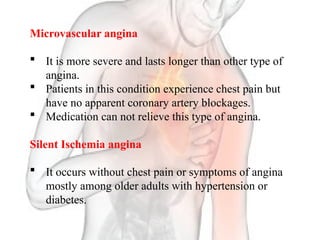 Angina Pectoris(Adult Health Nursing-I).pptx