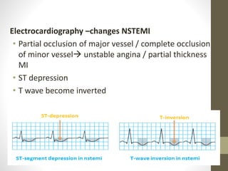 acute coronary syndrome (MI) | PPTX