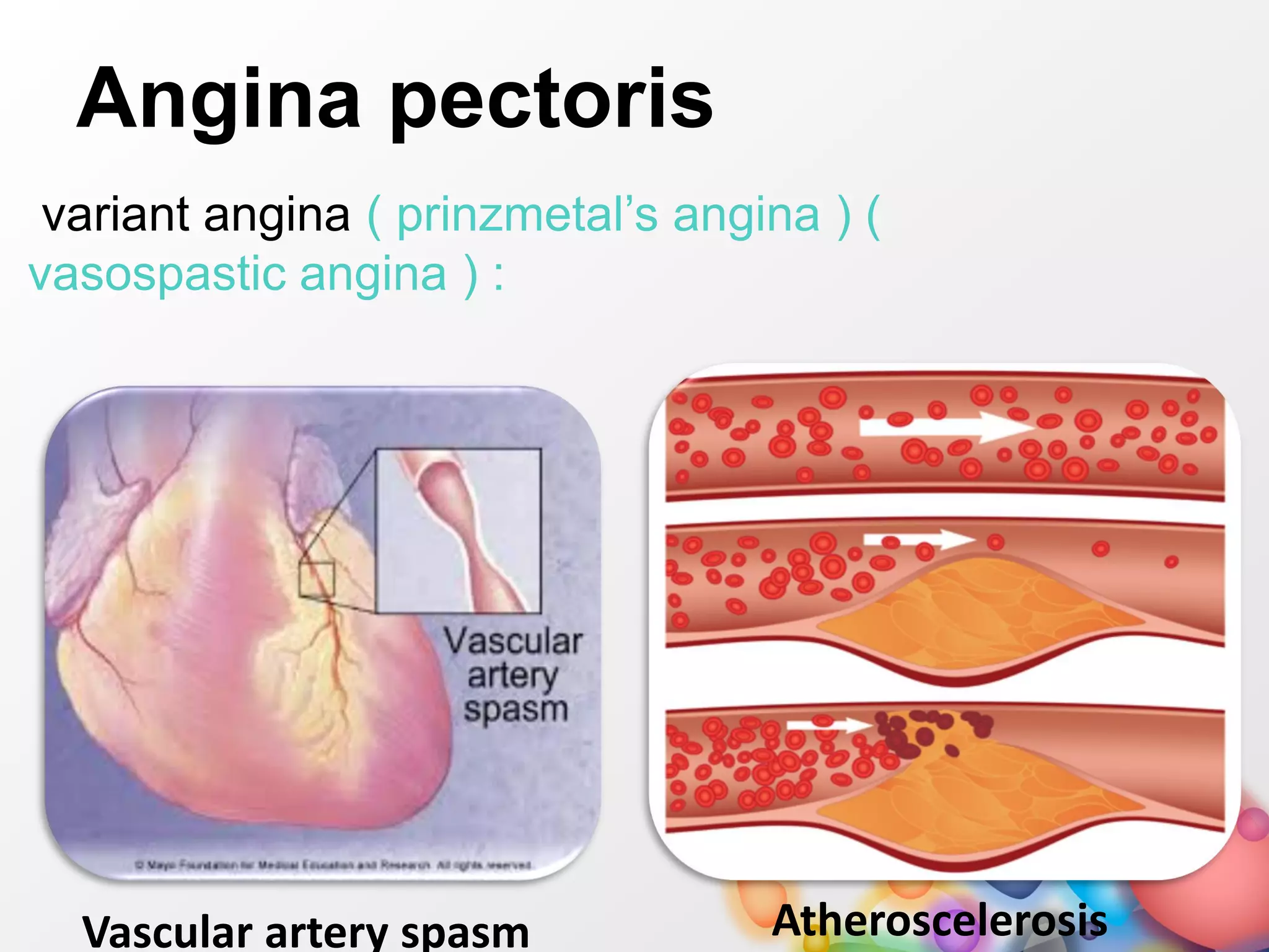 Angina pectoris by student at ahram canadian university | PDF