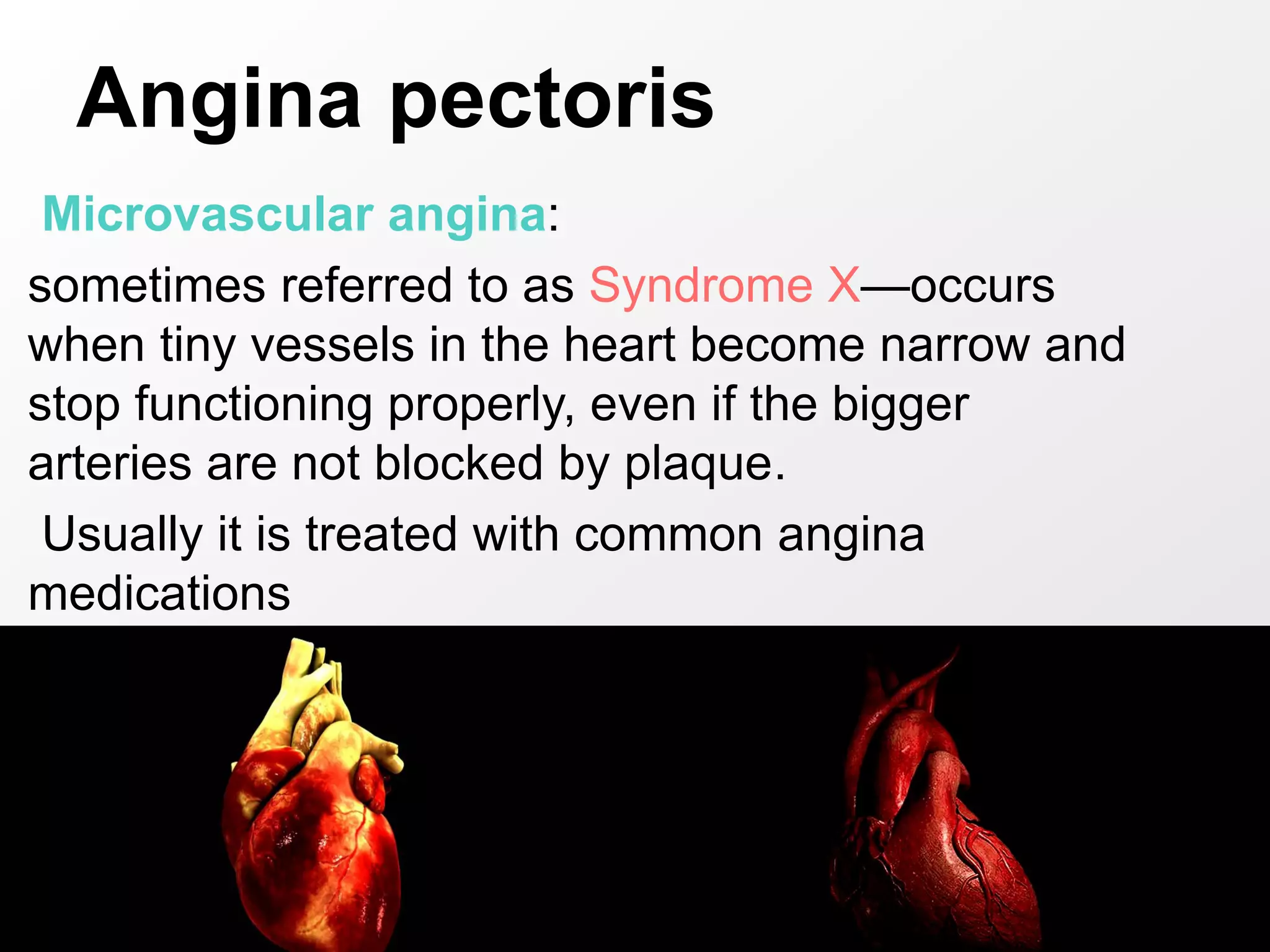 Angina pectoris by student at ahram canadian university | PDF