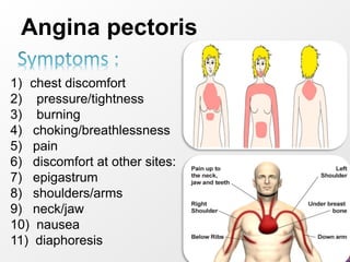 Angina pectoris by student at ahram canadian university | PDF