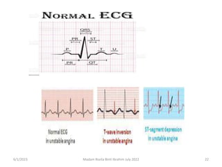 ANGINA PECTORIS DECREASE CARDIAC OUTPUT.pptx