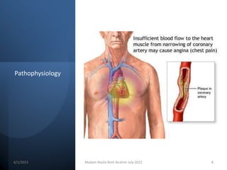 ANGINA PECTORIS DECREASE CARDIAC OUTPUT.pptx