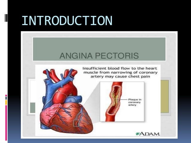 Angina pectoris ppt gnm 2 year | PPT