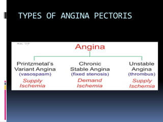 Angina pectoris ppt gnm 2 year | PPT