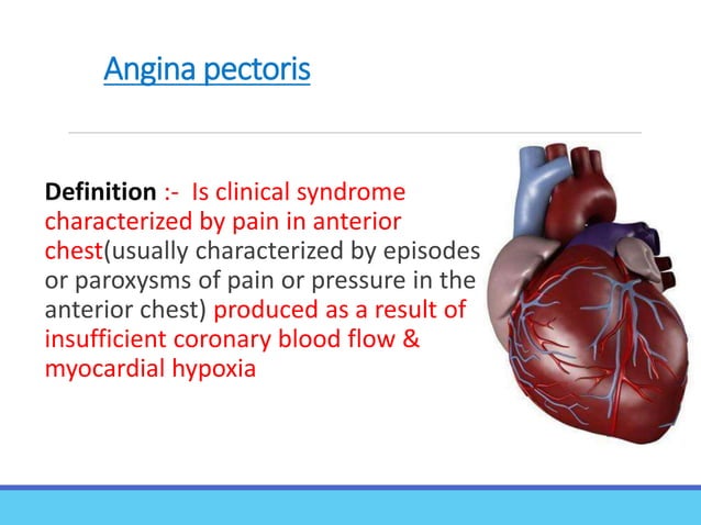 angina pectoris,seminar.pptx............ | PPTX | Heart and Cardiovascular Diseases | Diseases ...