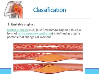angina pectoris,seminar.pptx............ | PPTX