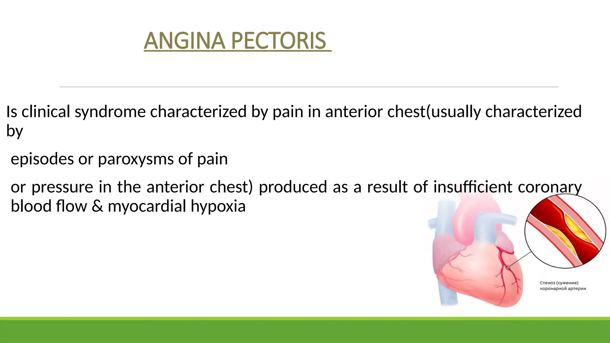 angina pectoris,seminar_16773487.30.pptx