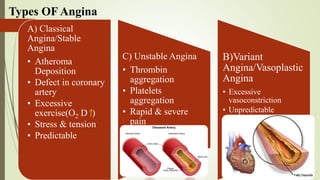 Angina pectroris | PPTX