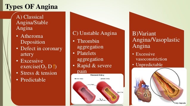 Angina pectroris