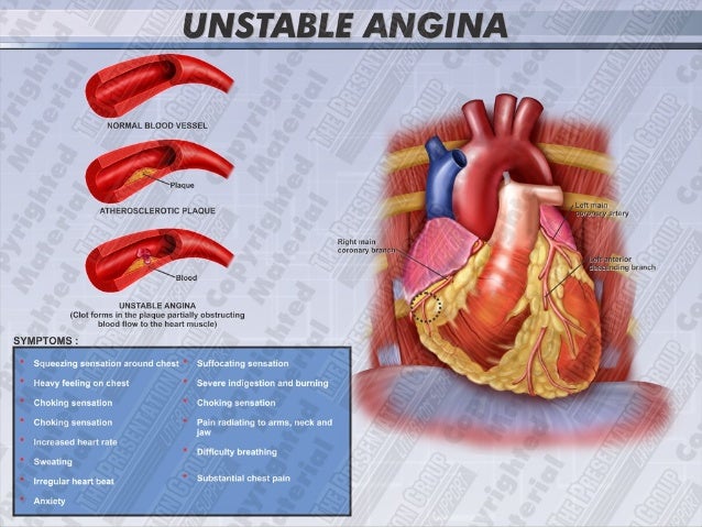 Angina pathophysiology