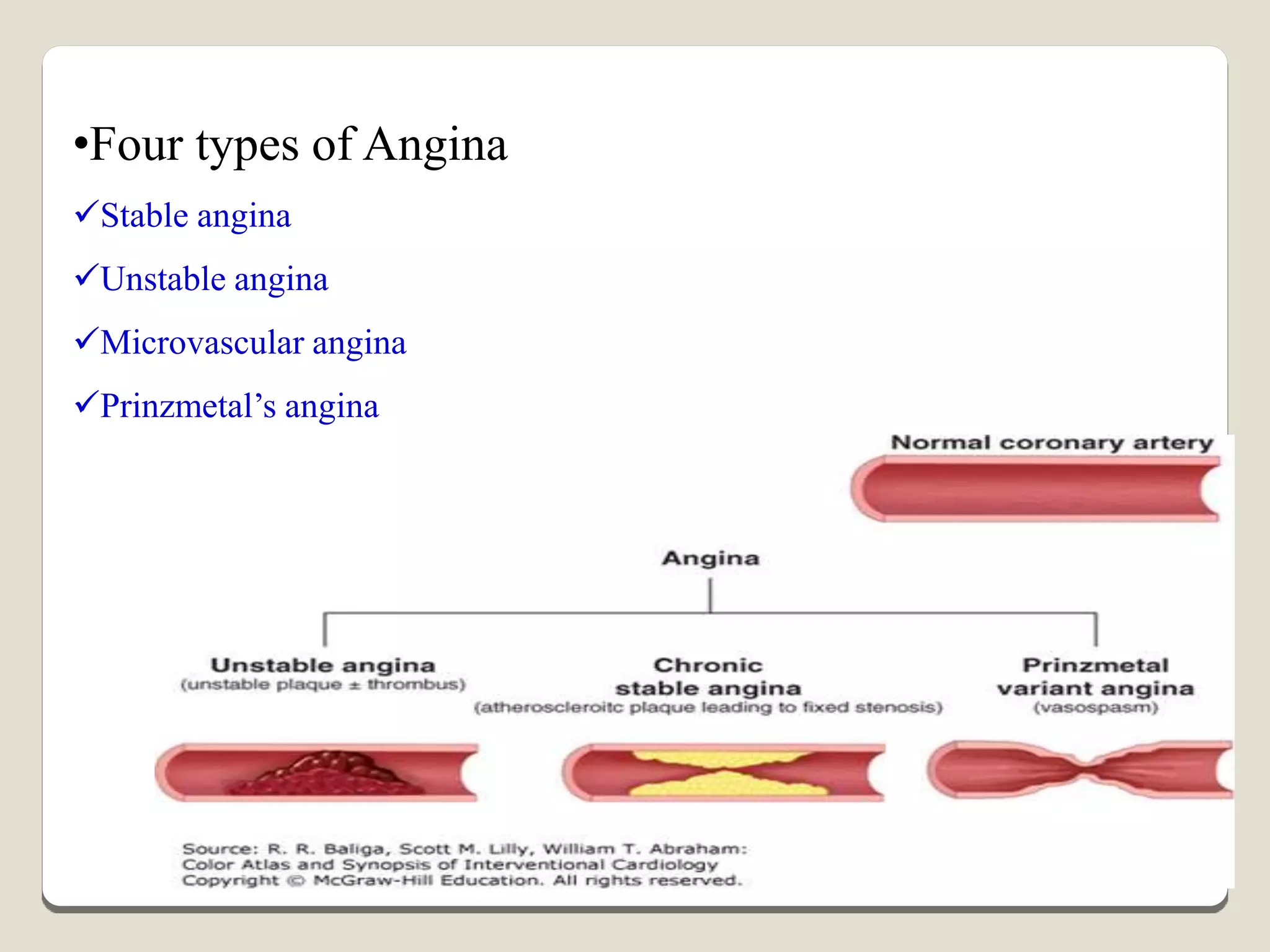 Angina PPT.ppt