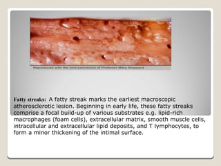 Angina PPT.ppt