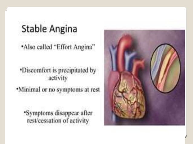 Angina PPT.ppt