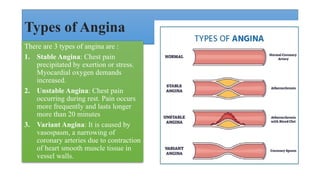 Screening Techniques and Toxicology of Angina | PPT