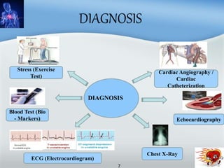 Angina seminar | PPTX