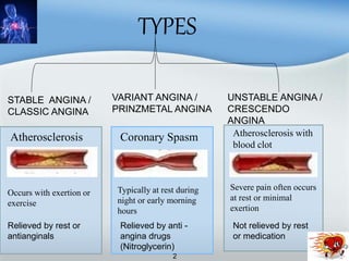 Angina seminar | PPTX
