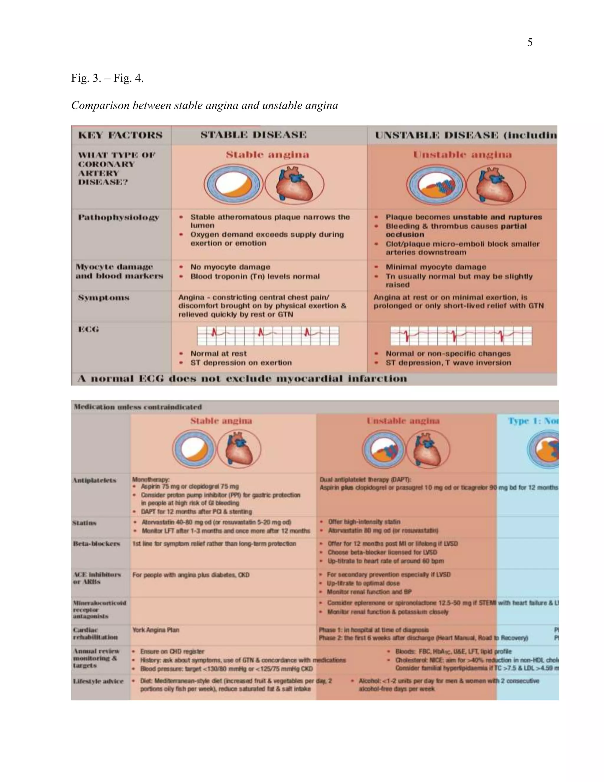Angina + SOAP note. | DOCX
