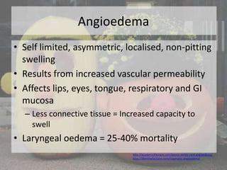 Angioedema | PPTX