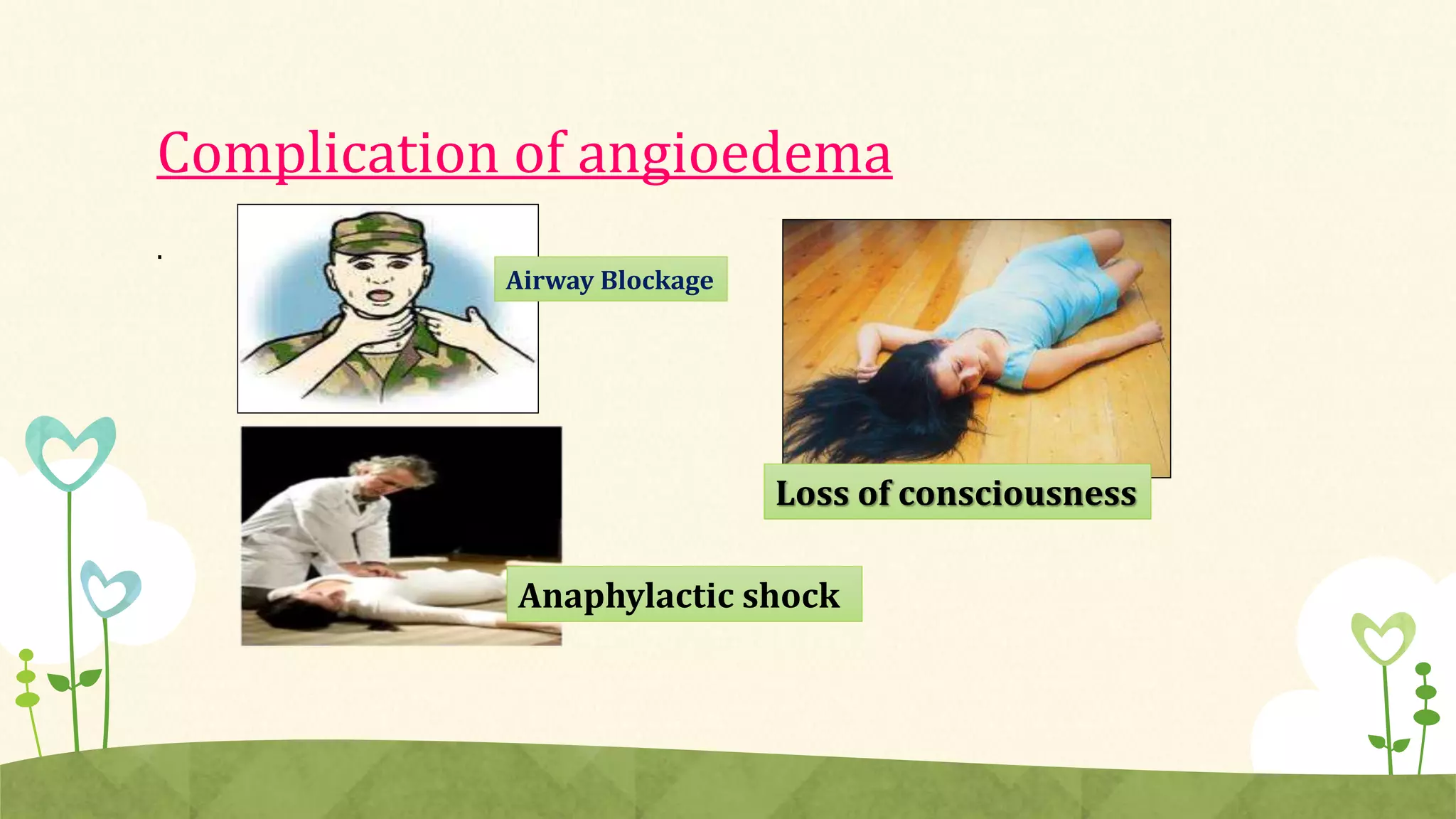 Angioedema | PPTX
