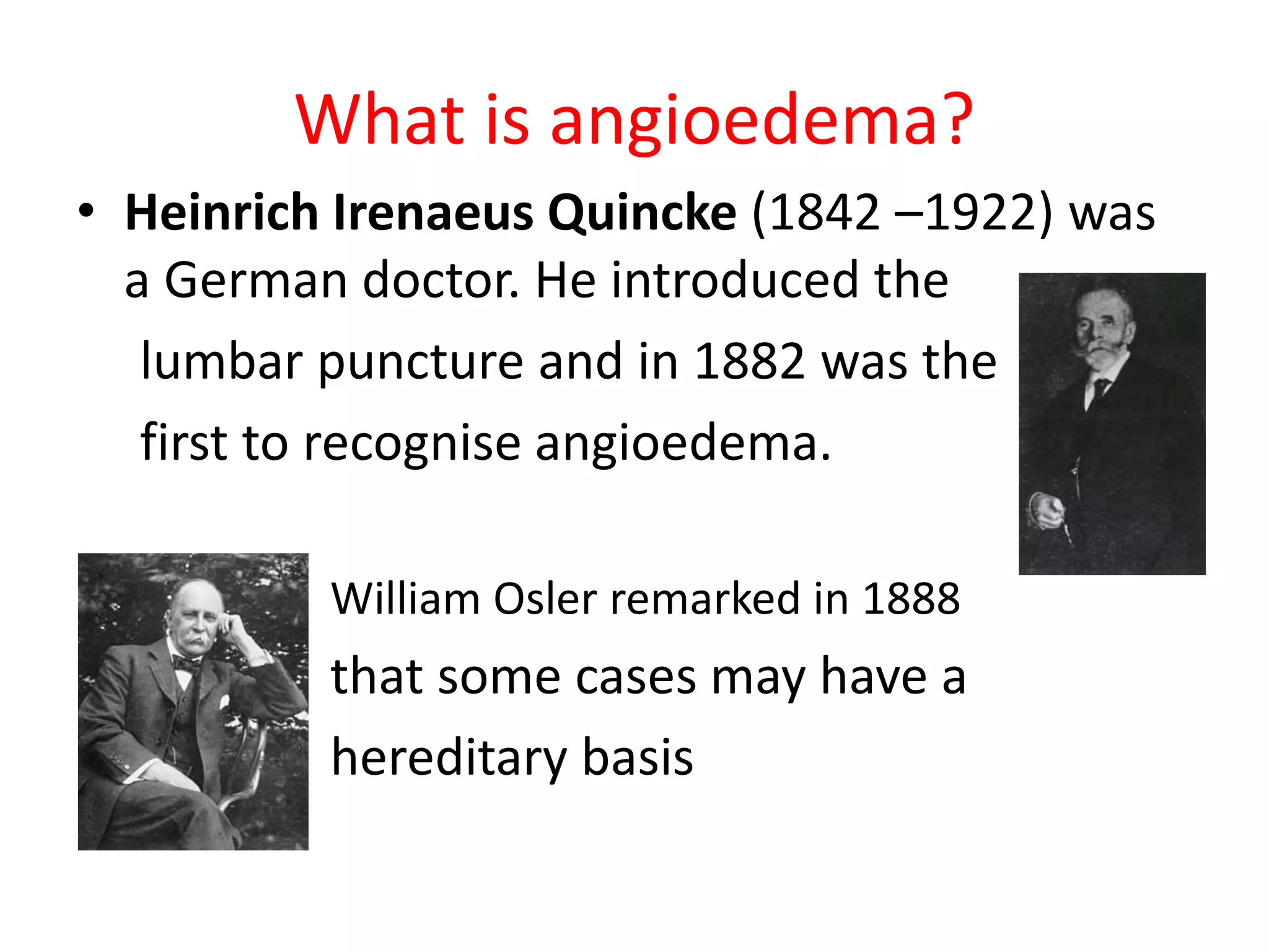 Angioedema | PPTX