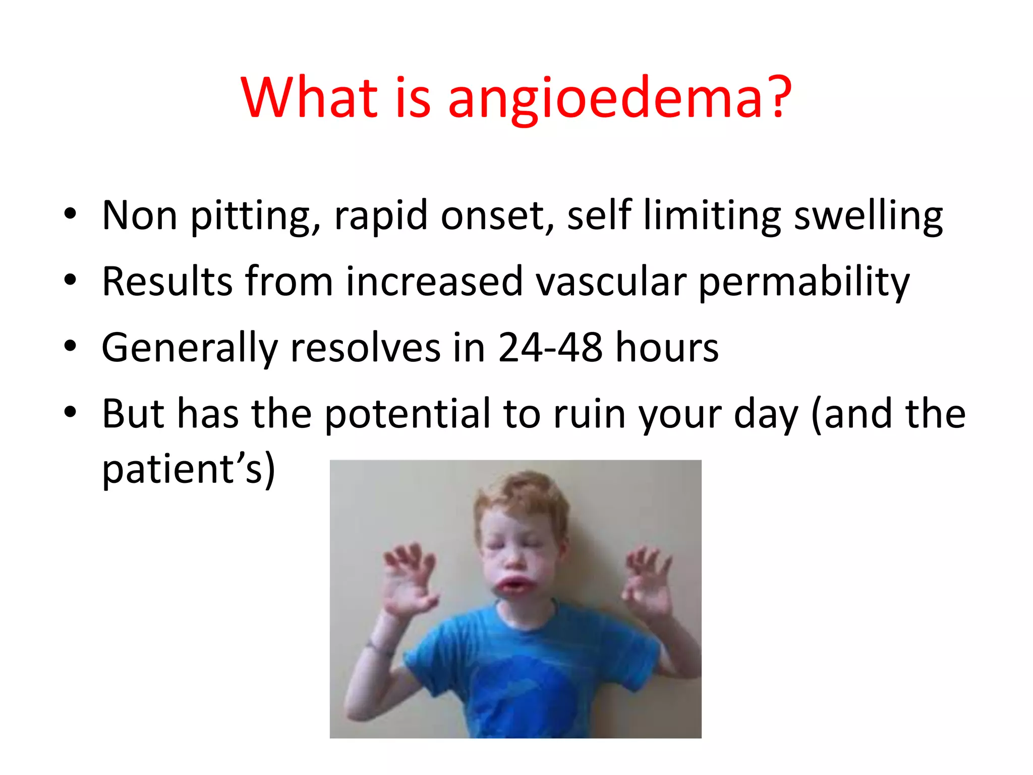 Angioedema | PPTX