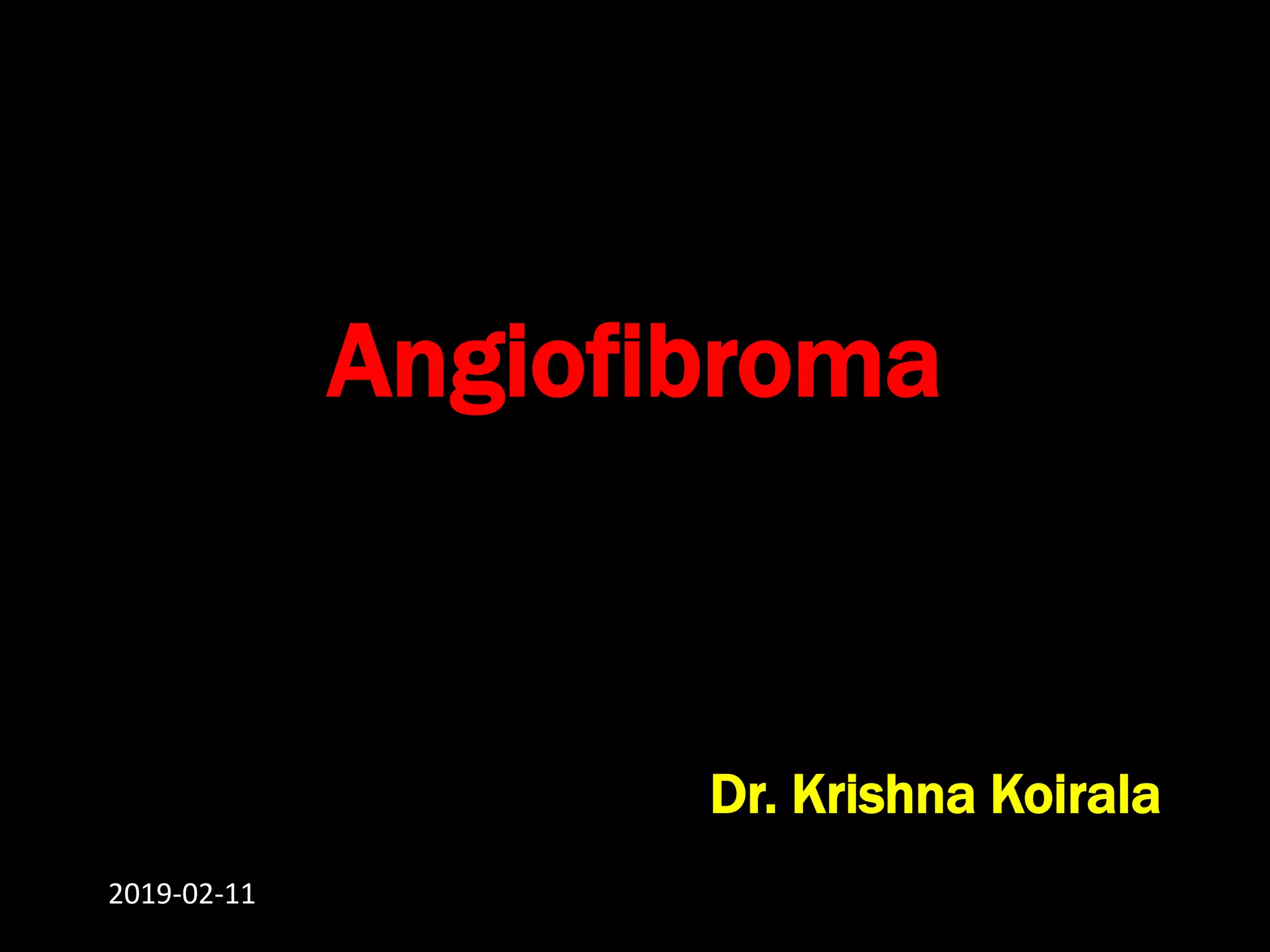 Angiofibroma | PPT