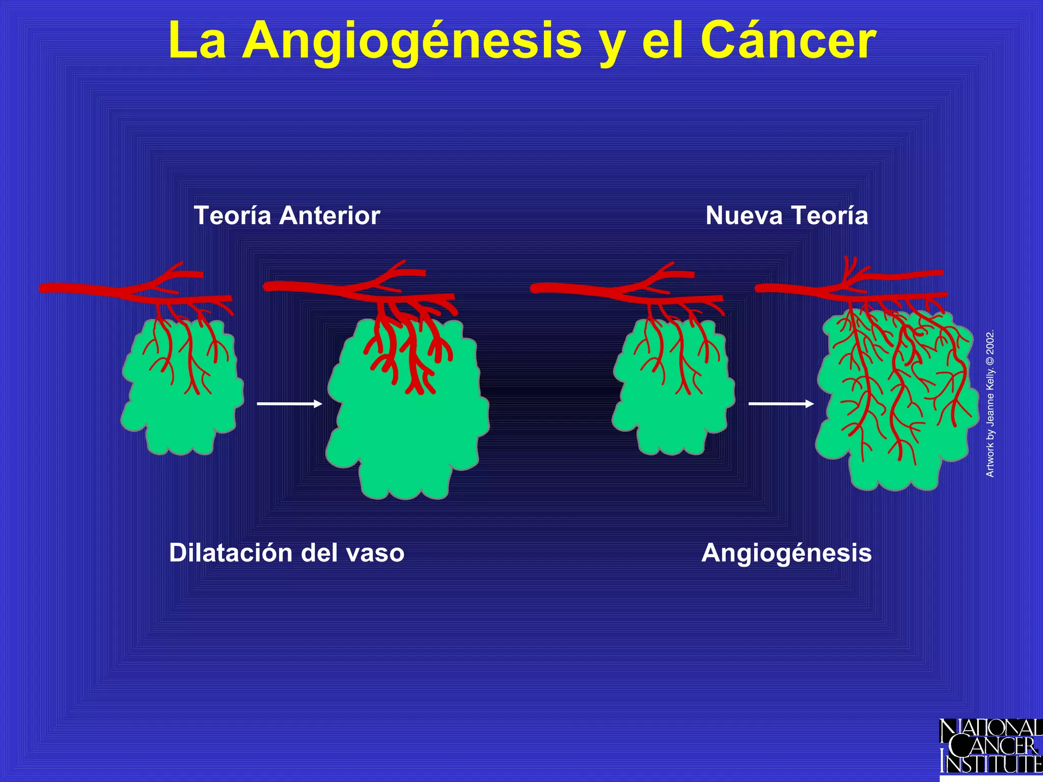 Entendiendo la Angiogénesis | PPT